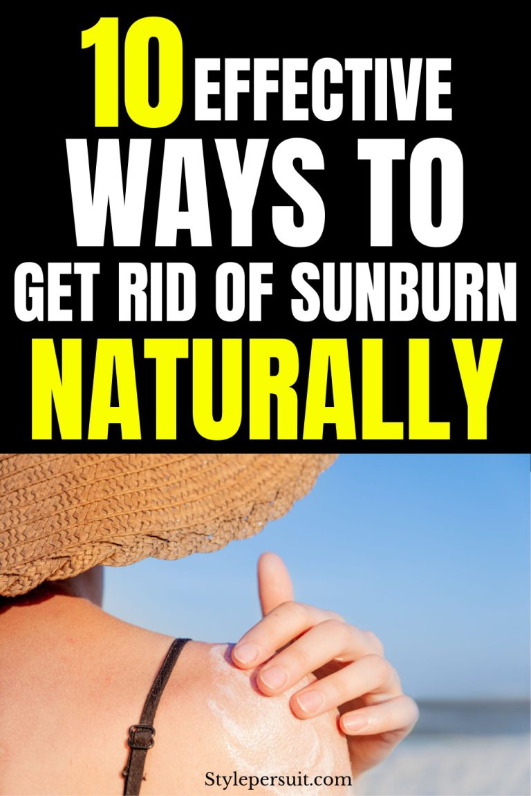 How to Get Rid of Sunburn Naturally - StylePersuit