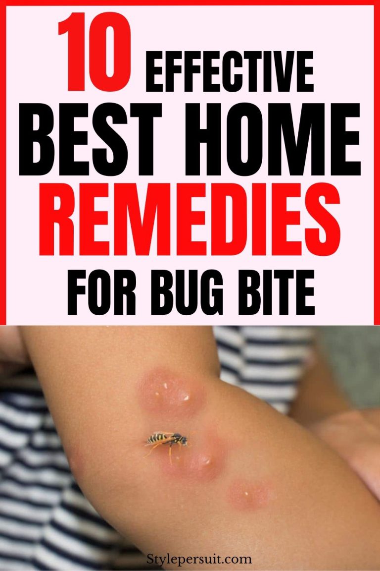 10 Best Bug Bite Relief Remedies That Work Fast – StylePersuit