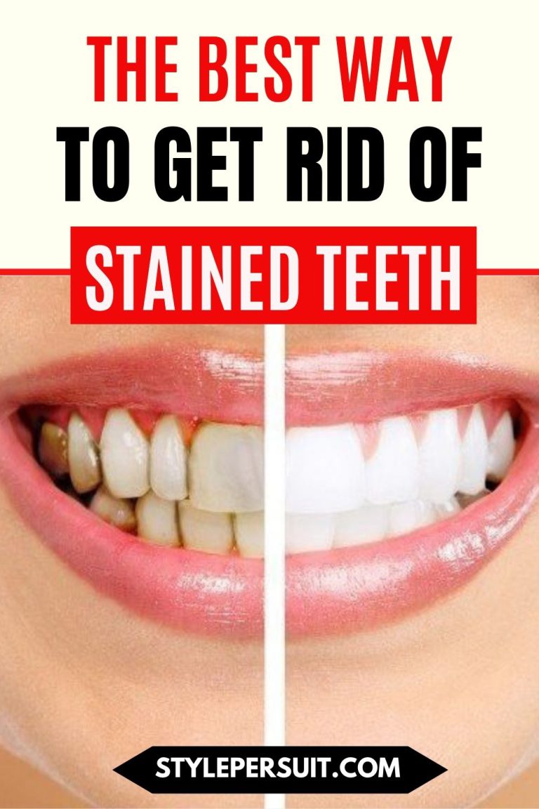 Stained Teeth: Understanding Types, Causes, and Treatments - StylePersuit