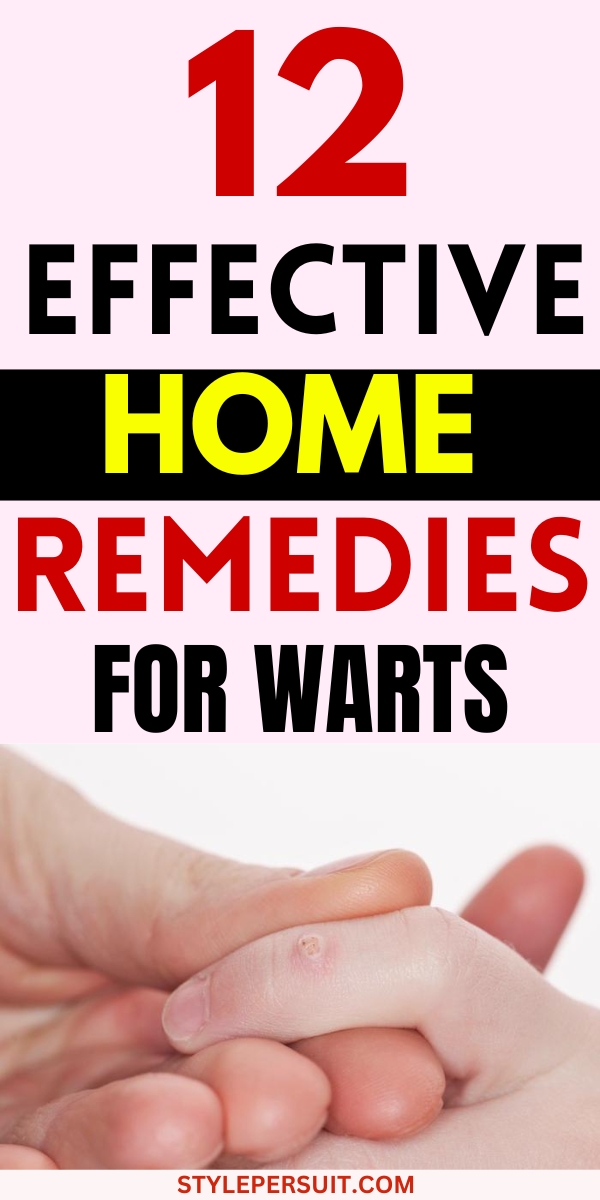 How to Remove Warts: 12 Best Home Remedies - StylePersuit